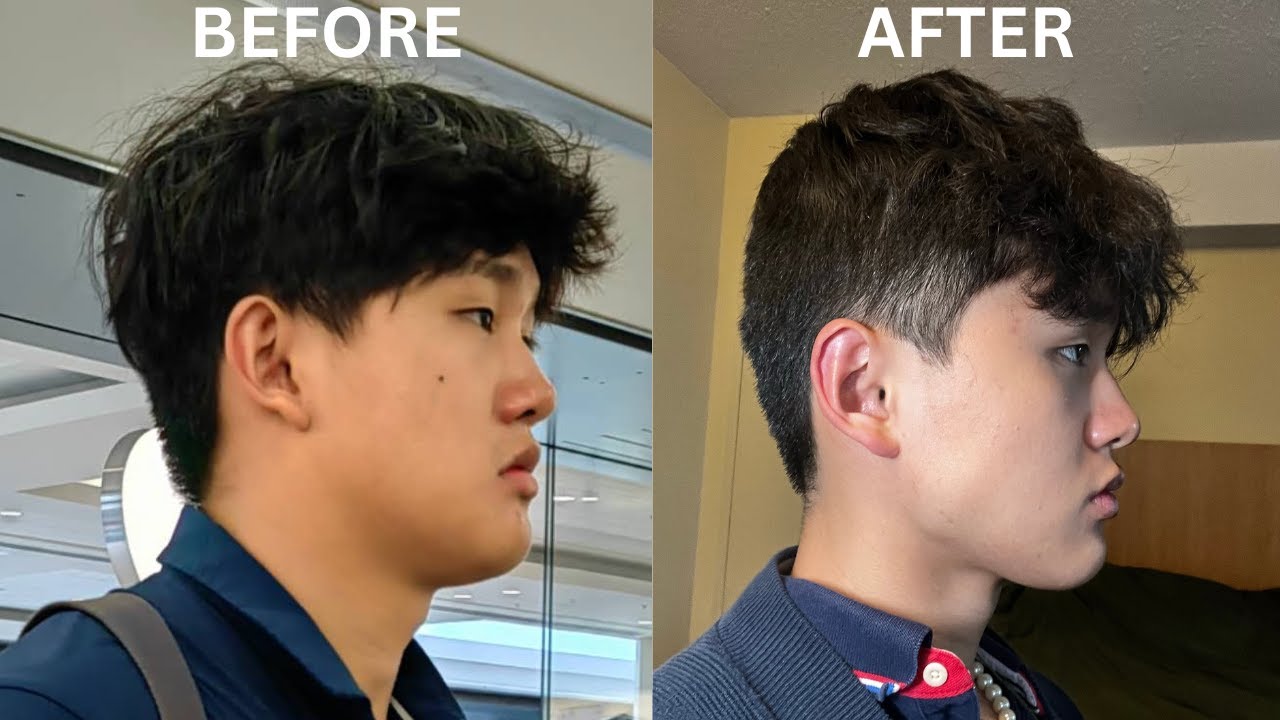 3-step guide to getting a jawline - YouTube