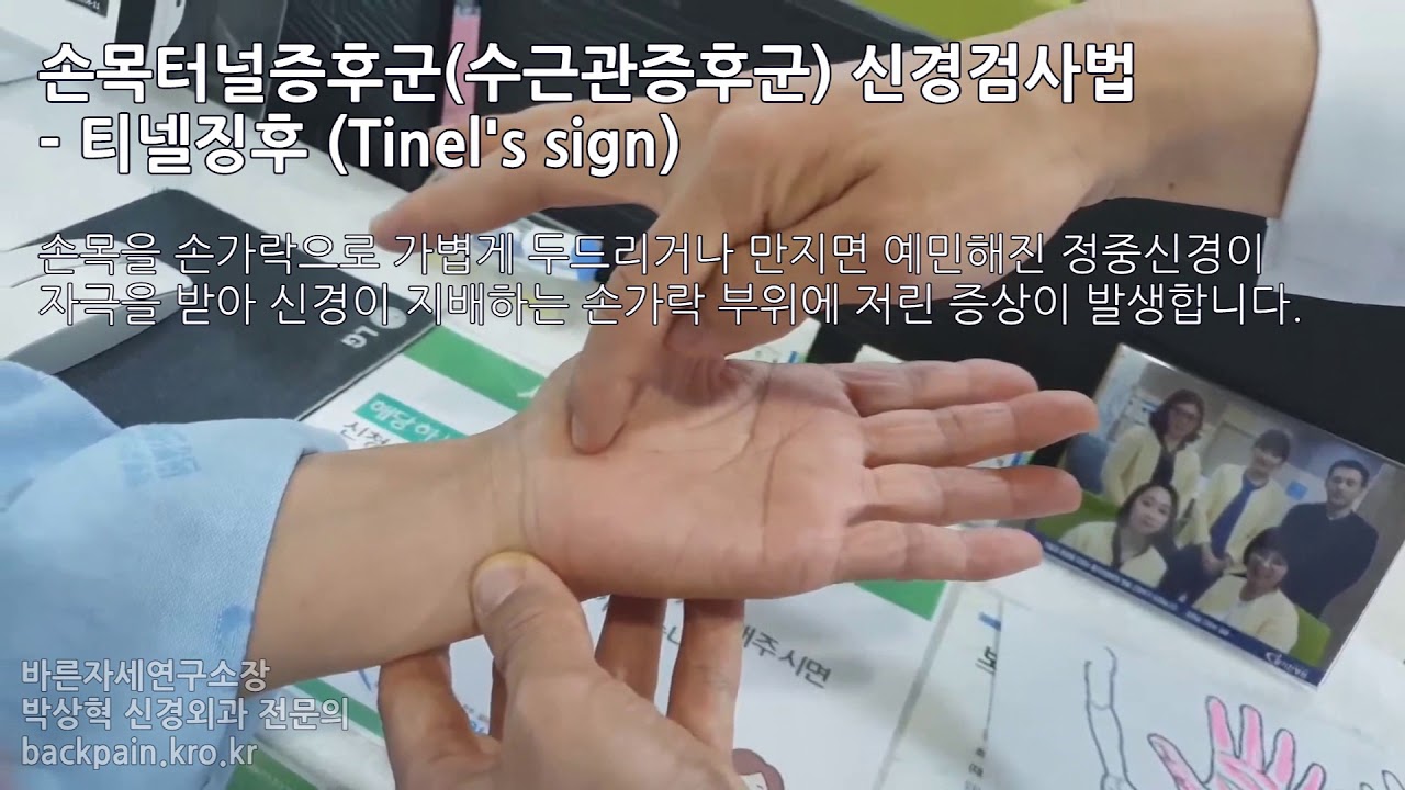 CTS 손목터널증후군 티넬징후 Tinel's sign - YouTube