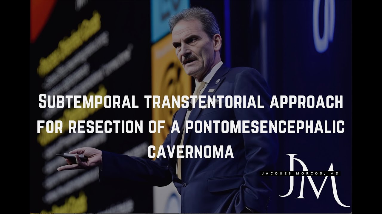 Subtemporal Transtentorial Approach for Resection of a ...