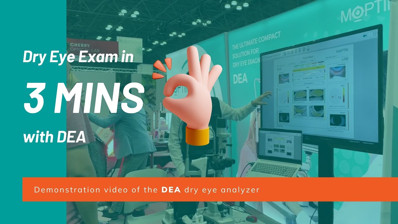 Moptim DEA: Dry Eye Exam with DEA in 3 Minutes! - YouTube