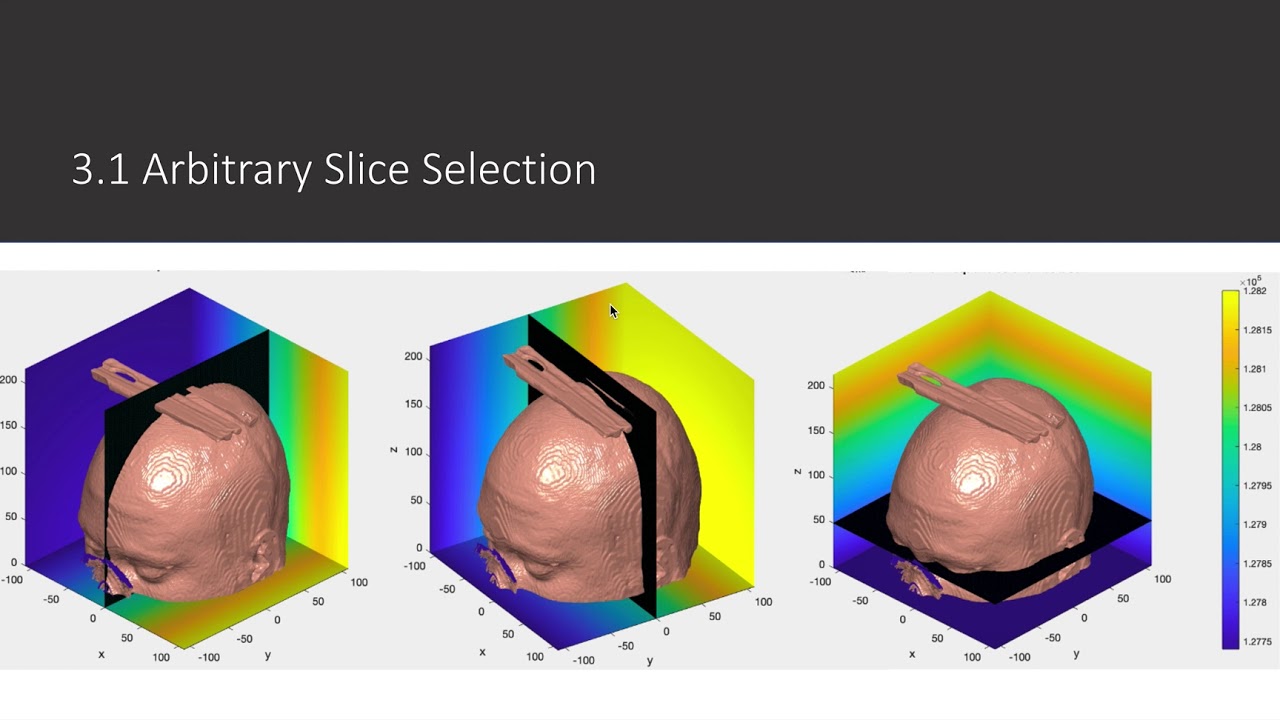 Magnetic Resonance Imaging (MRI) Simulator with Realistic Data ...