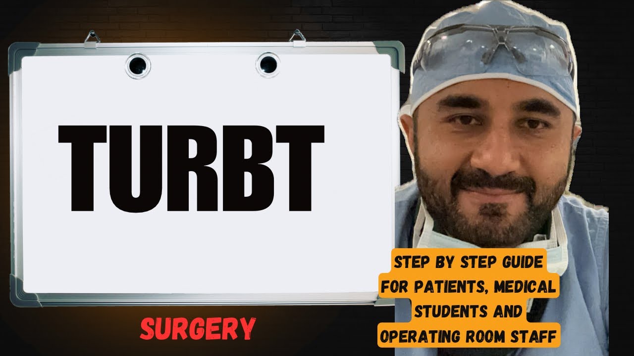 What to Expect for transurethral resection of bladder tumor TURBT ...
