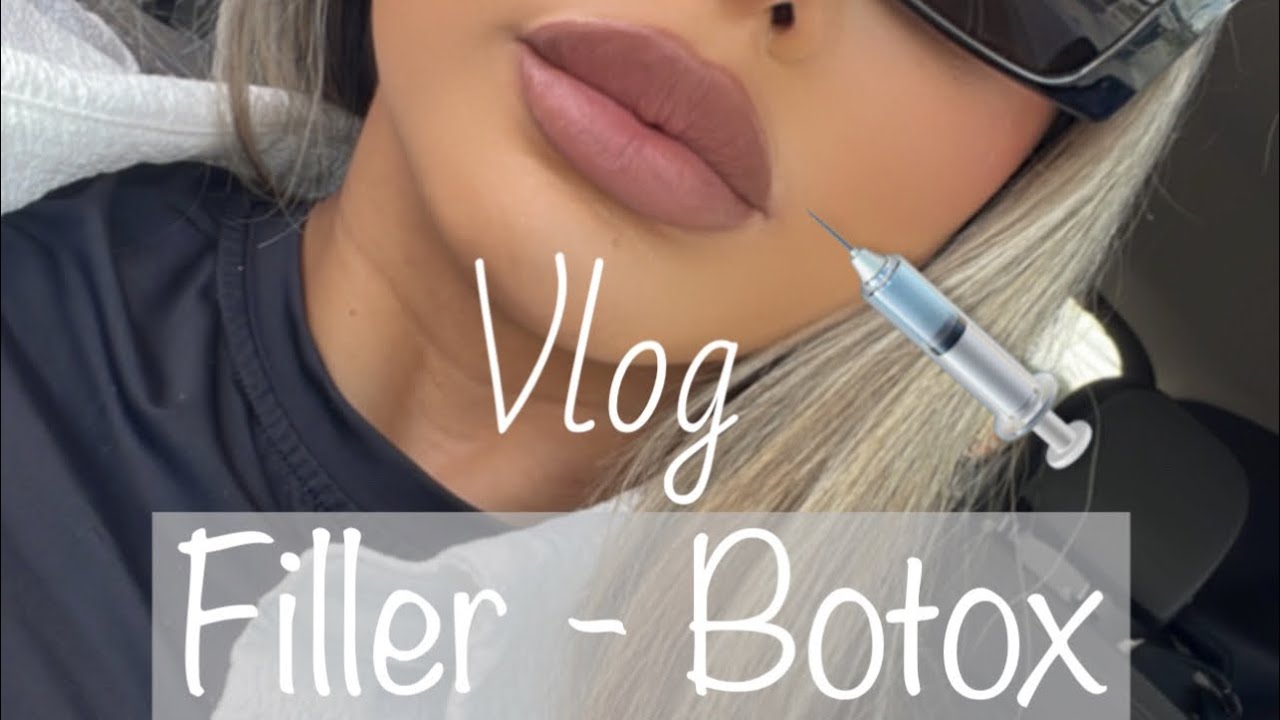 LIP FILLER | BOTOX | VLOG - YouTube