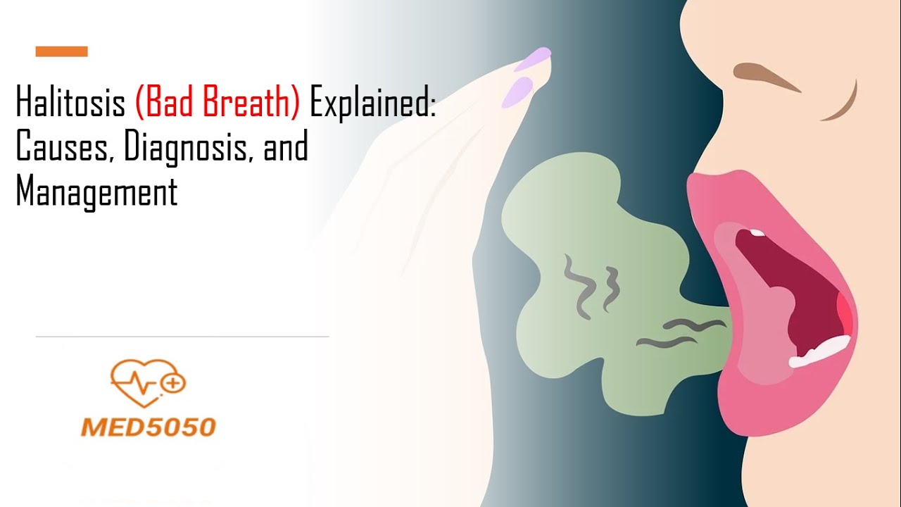 Halitosis (Bad Breath) Explained: Causes, Diagnosis, and Management ...