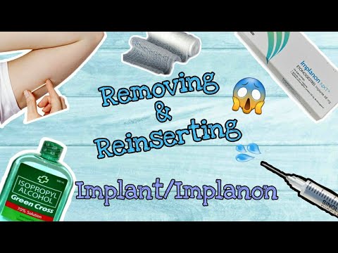 Removal & Reinserting (Implant/Implanon) - YouTube