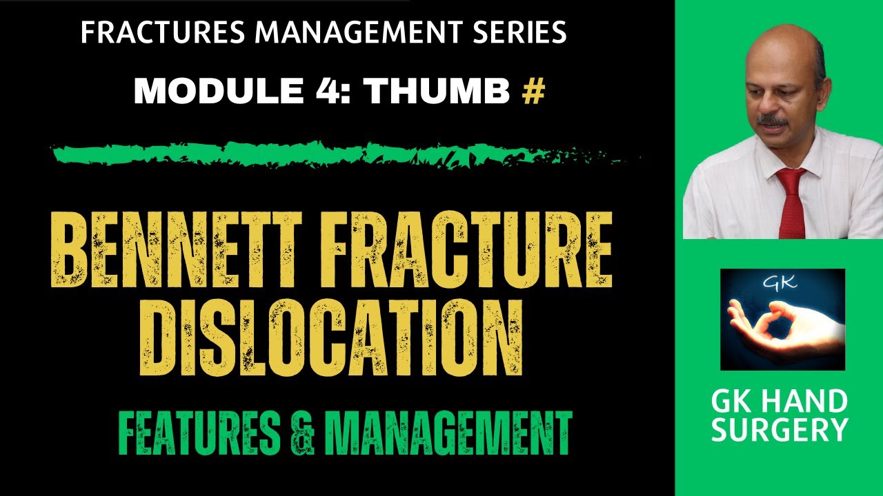 Thumb fractures: The Bennett fracture dislocation - The basics and ...