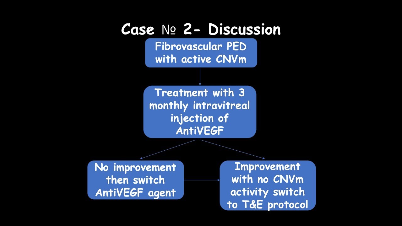 Clinical changes in RPE- Case report (part two) - YouTube