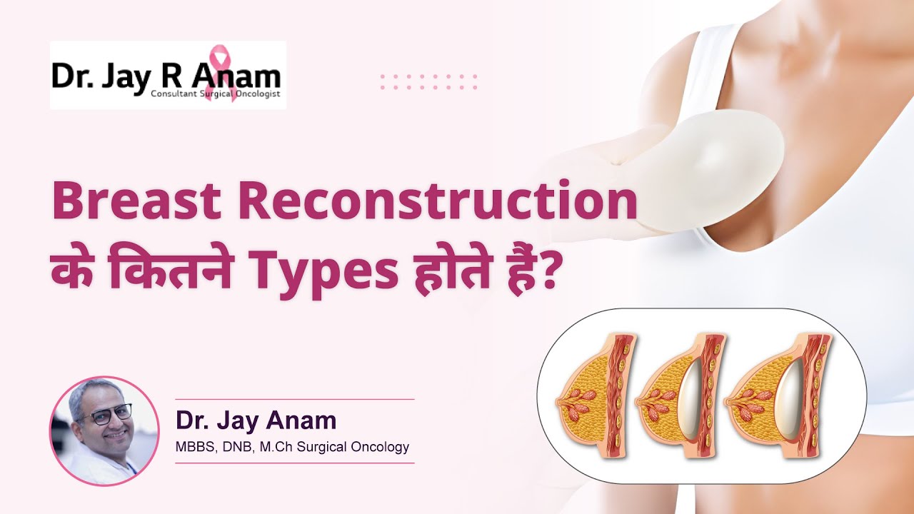 Breast Reconstruction के कितने Types होते हैं? | Restoring Beauty After Cancer | Dr Jay Anam ...