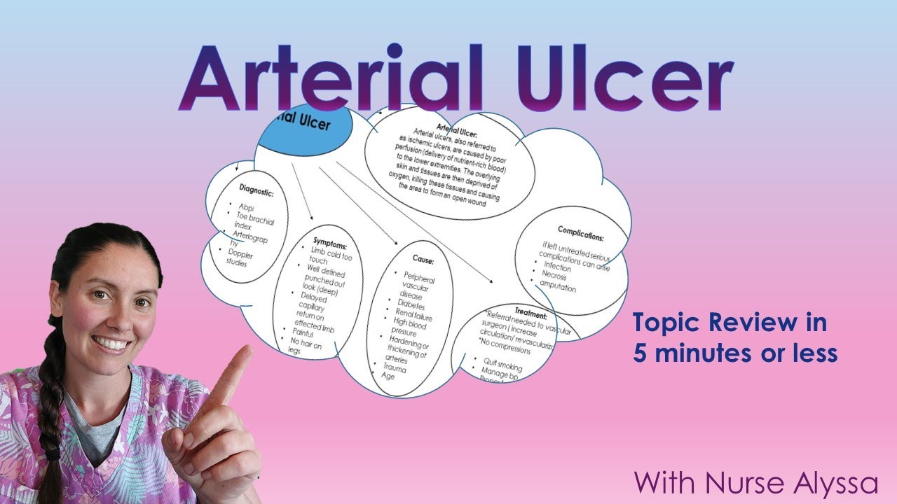 Arterial Ulcer Mind map - YouTube