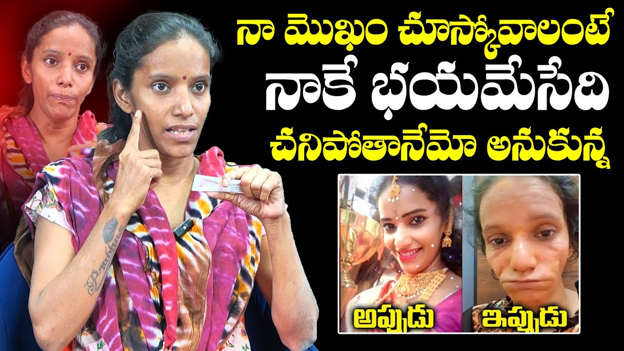 Local Pilla Lakshmi Exclusive Interview | Local Pilla Influencer ...