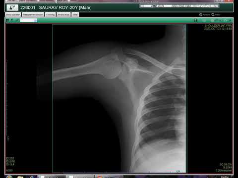 HOW TO ENTRY, PROCESS AND PRINT XRAY ON FUJIFILM PRIMA T2 CR ...