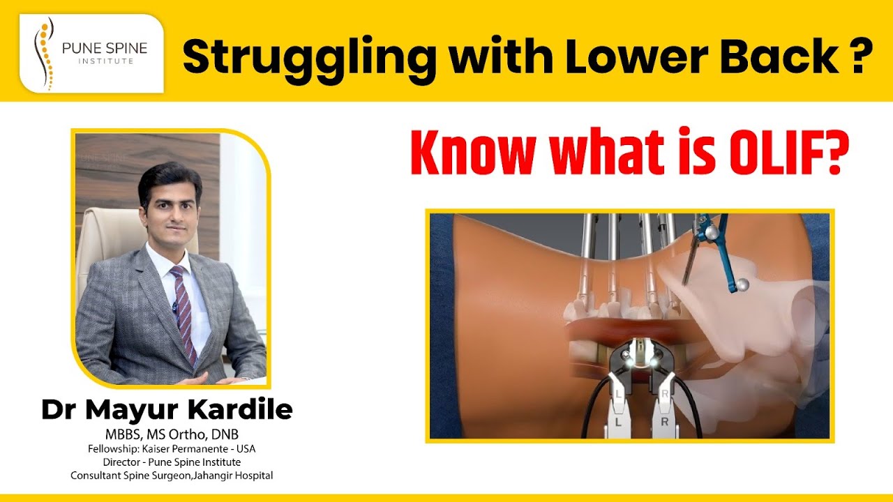 What is OLIF Surgery? | Know its Benefits | Dr. Mayur Kardile Spine ...