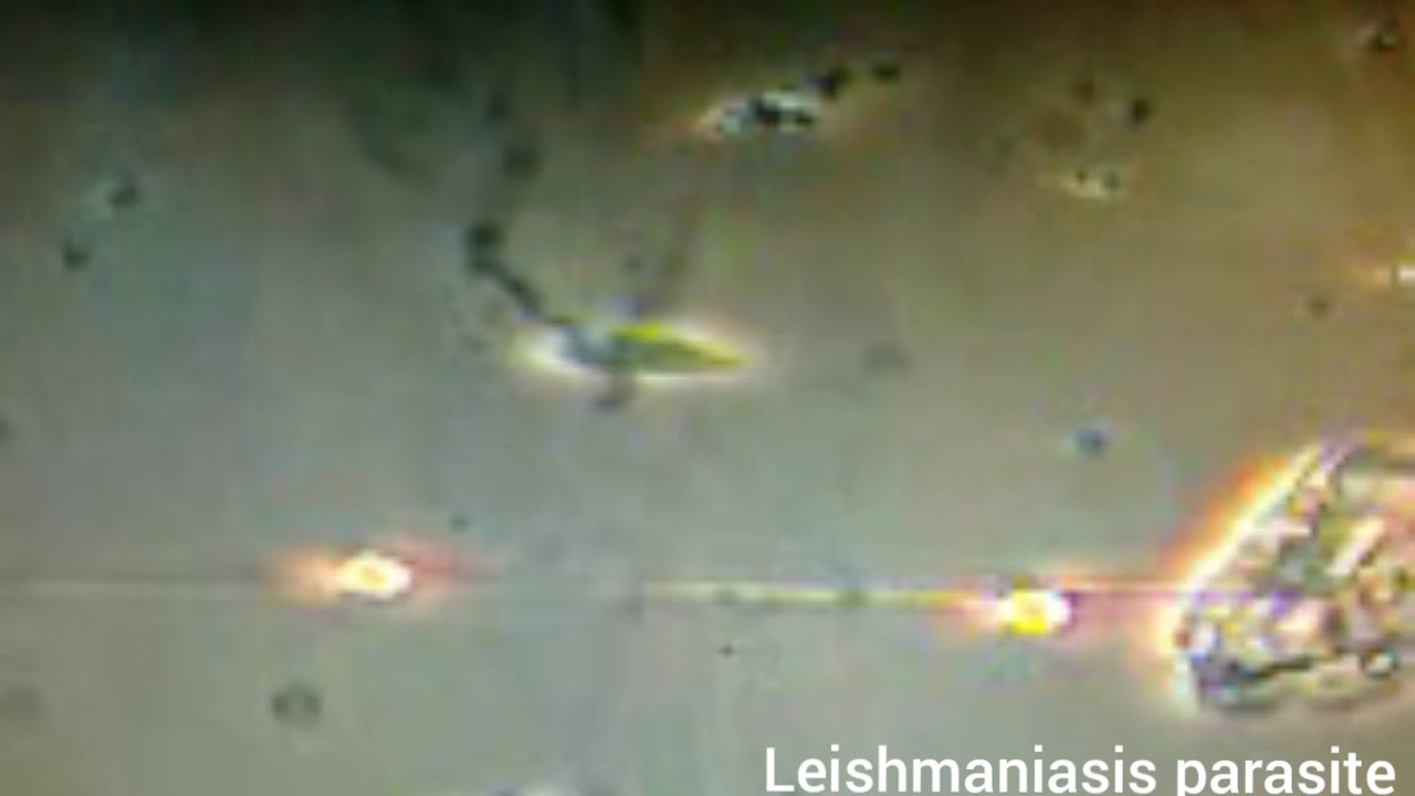 Leishmaniasis parasite under microscope /\ Amazing microbes - YouTube