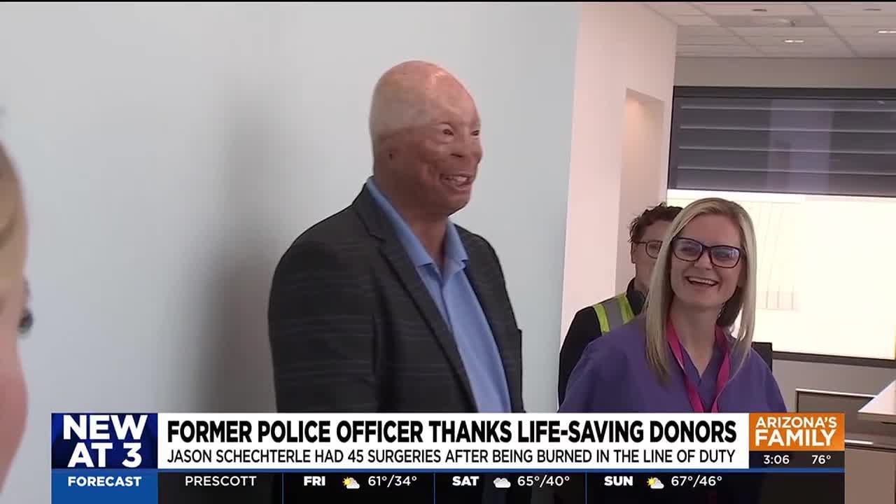 Former police officer burned in crash thanks life-saving blood donors ...