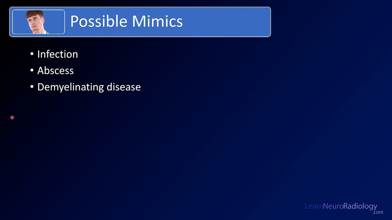 Emergency Imaging of Brain Tumors: Tumor mimics - YouTube