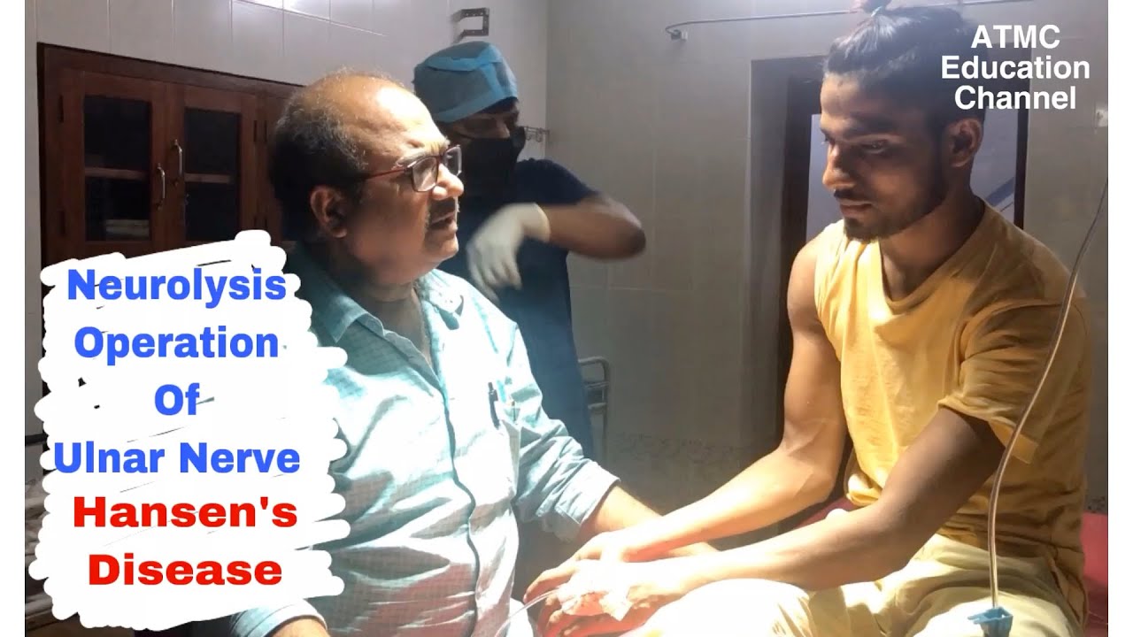 Ulnar nerve Neurolysis,Hansen’s disease,Claw hand,Muscle waisting ...