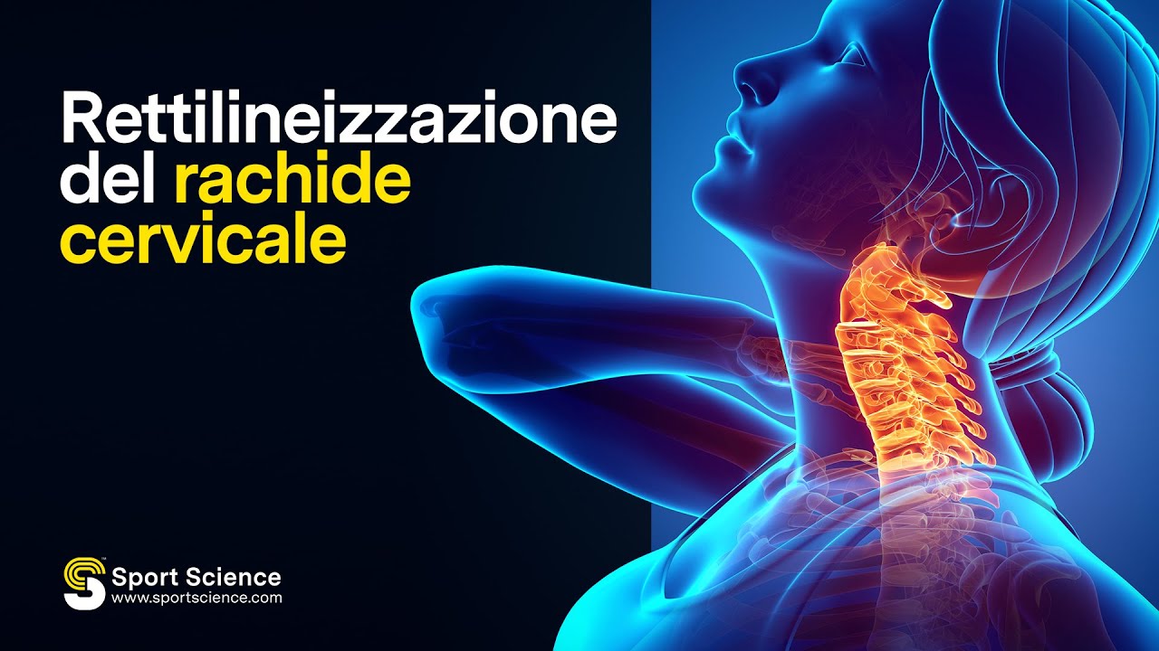 RETTILINEIZZAZIONE del RACHIDE CERVICALE: cosa fare? - YouTube