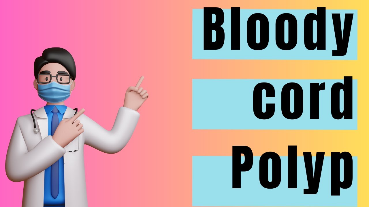 Bloody Vocal cord Polyp ( Hemorrhagic ) causing change of voice - YouTube