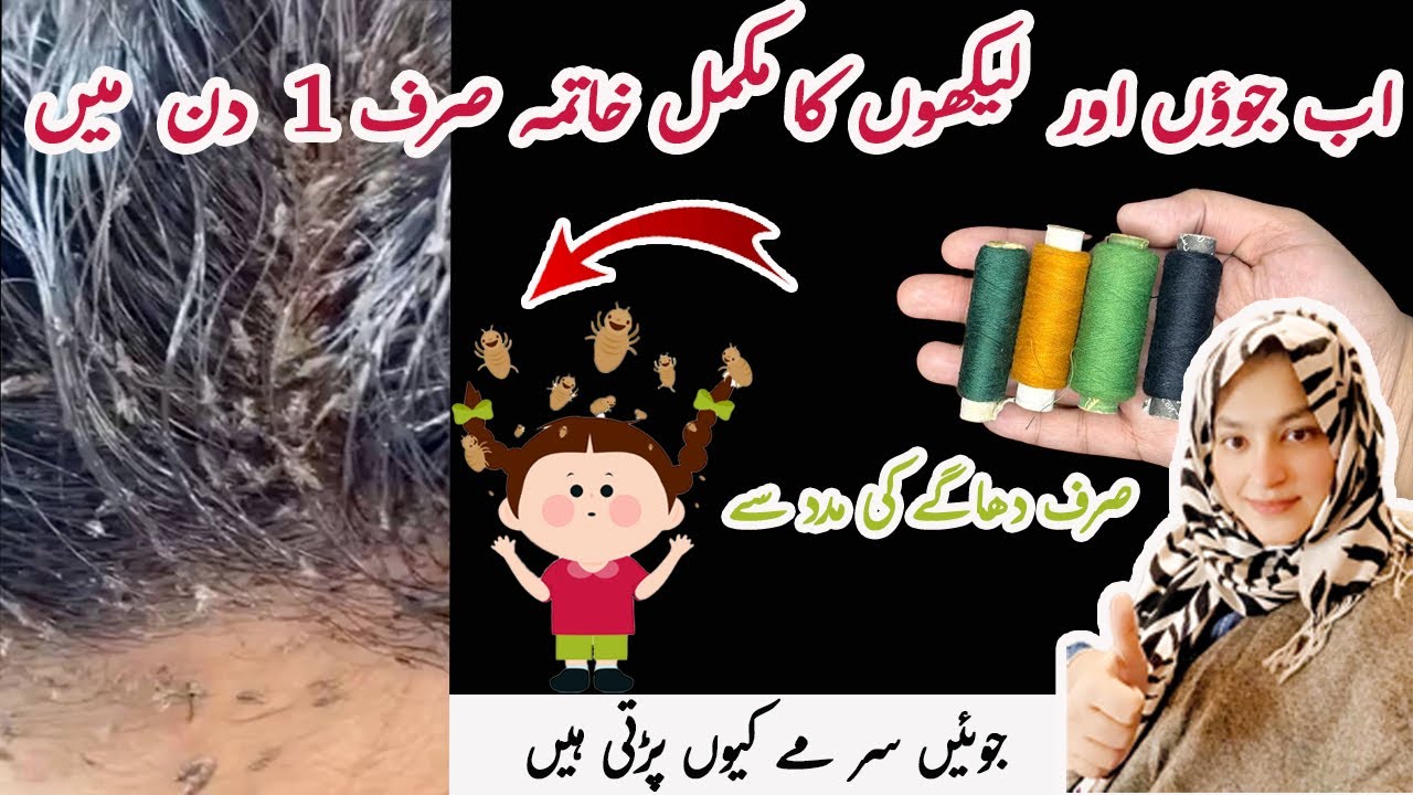Get Rid From Lice's With Thread 😱 | Cleaning Tips | Amazing Kitchen ...