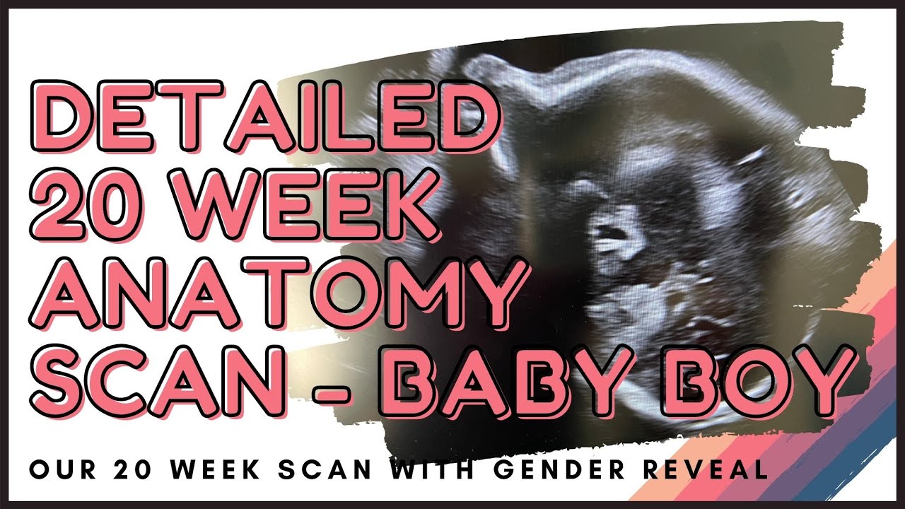 ANATOMY SCAN BABY BOY! | 20 WEEKS | UK MUM VLOG - YouTube