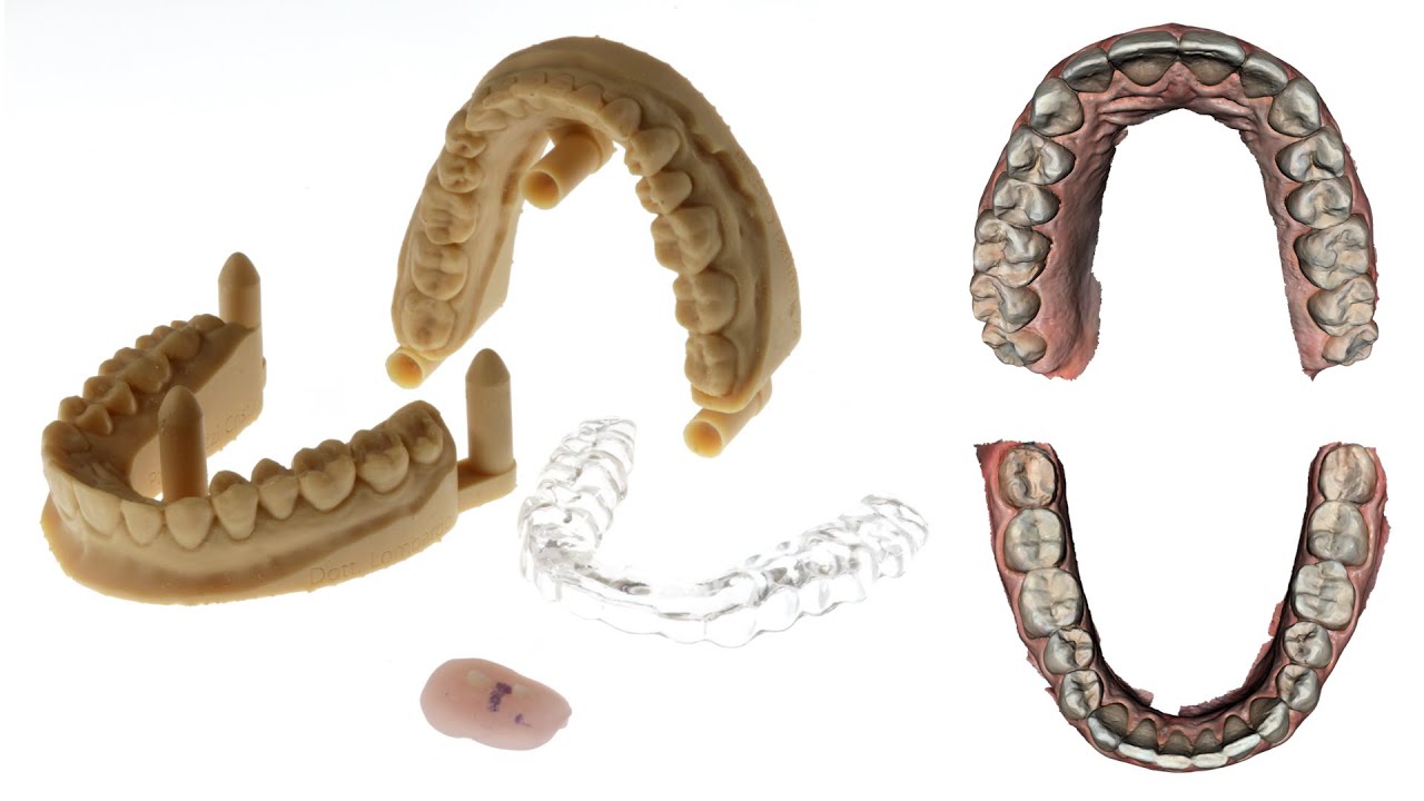 IOS & CAD-CAM Michigan Splint: JIG for DEPROGRAMMED, PASSIVELY RETRUDED ...