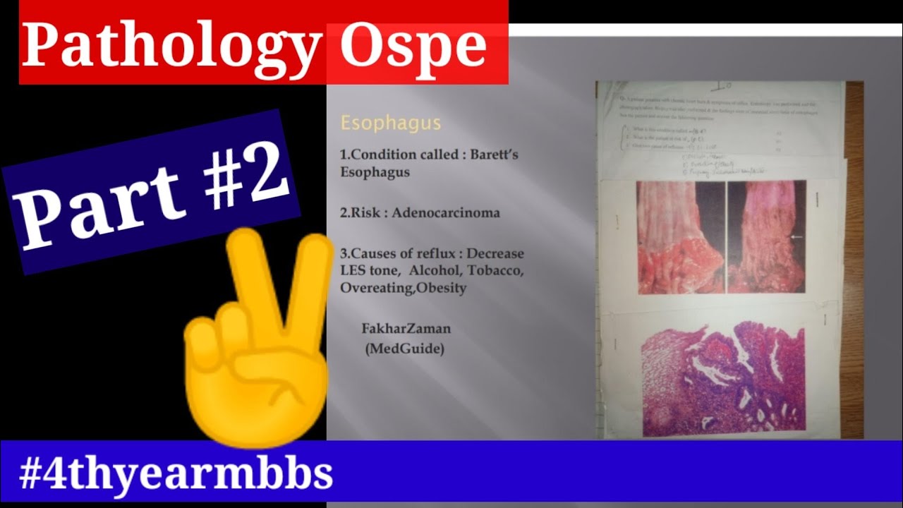 Special pathology 🔴 ospe Part #2. Important questions with a answers ...