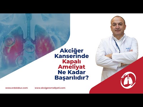 AKCİĞER KANSERİNİN KAPALI AMELİYATI BAŞARI SAĞLAR MI?