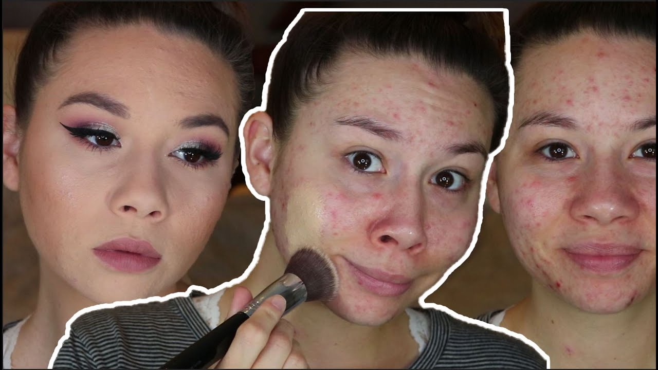 The Results are SHOCKING! | Almay Clear Complexion Make Myself Clear ...