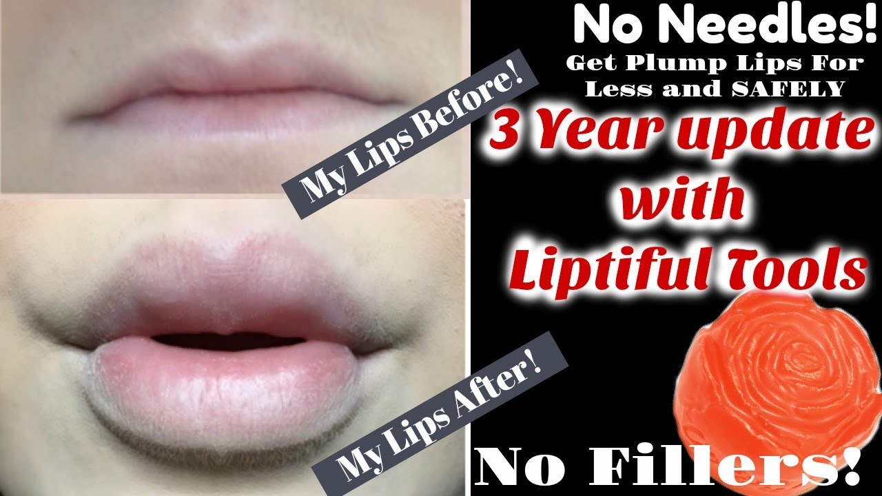 Full Lips Without Injections! 3 YEAR Liptiful Tool Update - YouTube