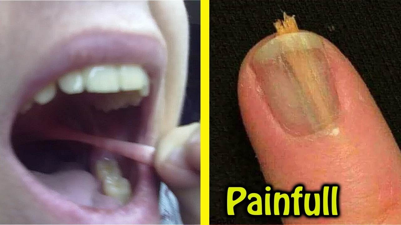 30 Most Unsatisfying Pictures Ever! - YouTube