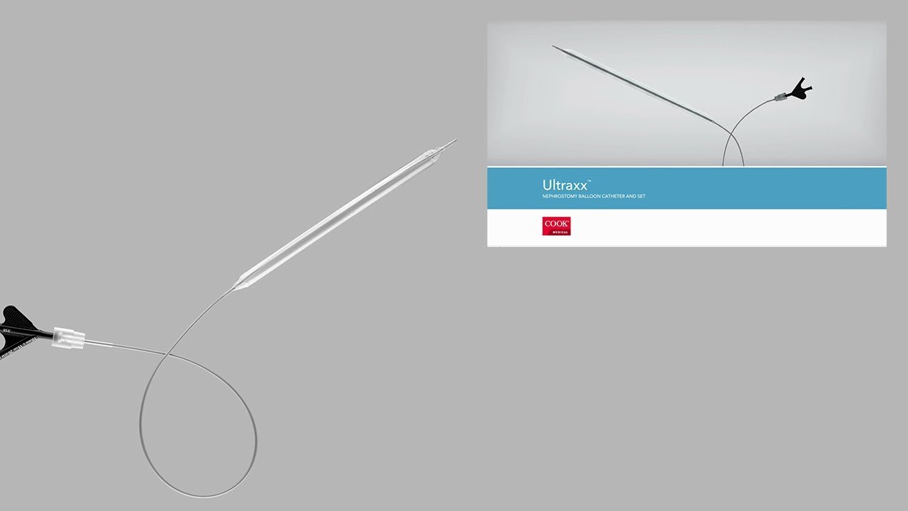 Procedimento de Dilatação Renal com Balão Ultraxx™ Cook Medical - YouTube