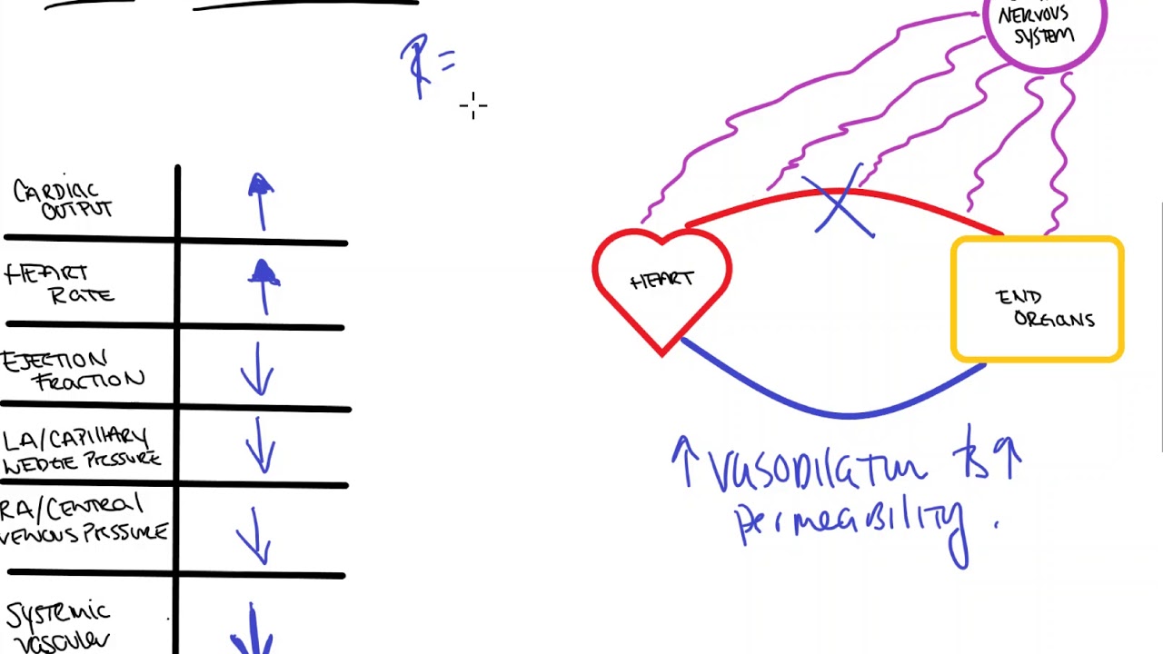 Distributive Shock - YouTube