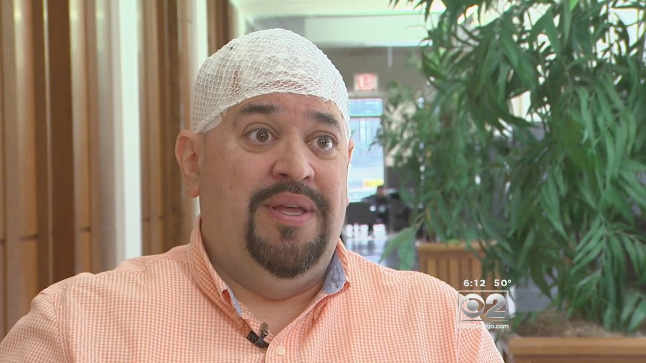 Electrode Cap Helping Keep Man’s Brain Tumor At Bay - YouTube