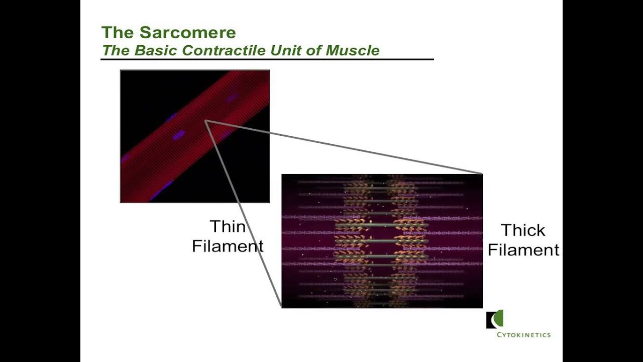 FSH Society Atlanta Meeting: Considering clinical trials in muscle ...