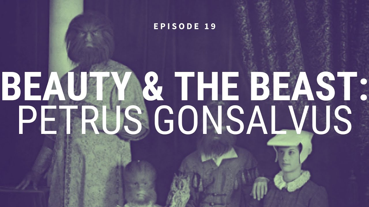 Beauty & The Beast: Petrus Gonsalves - YouTube