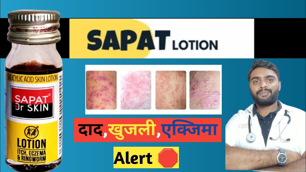 Sapat Dr Skin Lotion-Red Alert 🛑 | Sapat Lotion For Fungal infection ...