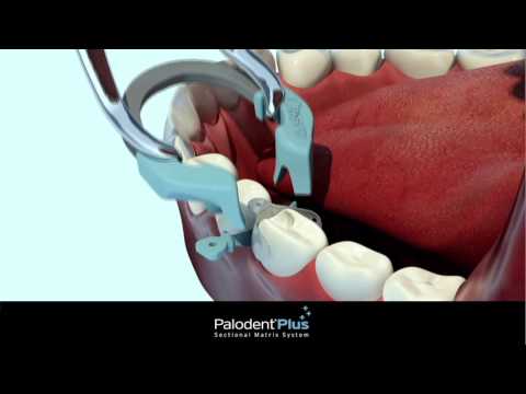 An overview of the Palodent Plus from Dentsply Caulk - YouTube