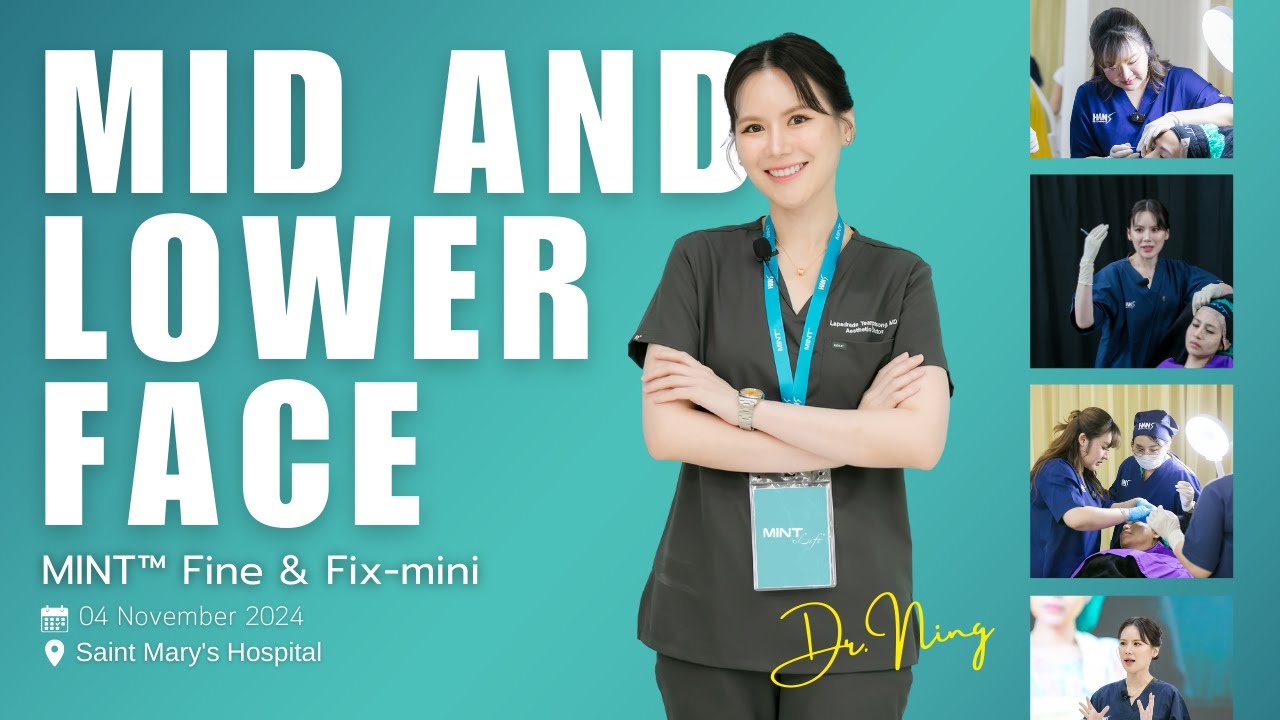 Highlight!! Mid and Lower Face (MINT™ Fine and MINT™ Fix-mini) - YouTube