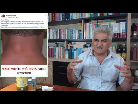 Yağ Bezesi Nasıl Tedavi Edilir ? Yağ Bezesi Olanlar Ne Kullanmalı ? Yağ Bezesi Nasıl Geçer ?