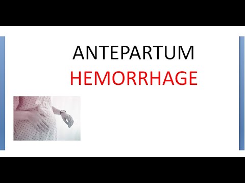 Obstetrics 304 AntePartum Hemorrhage Definition Define APH Causes ...