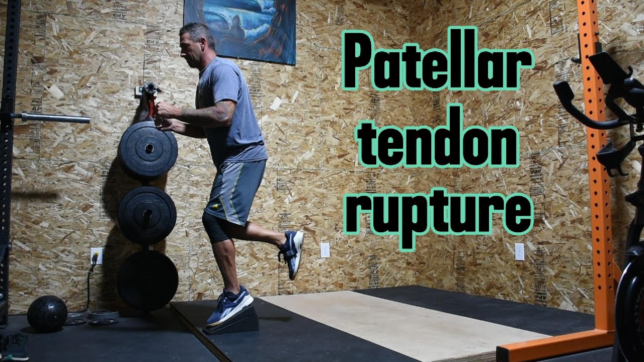 14 week update on my recovery from a ruptured patellar tendon - YouTube