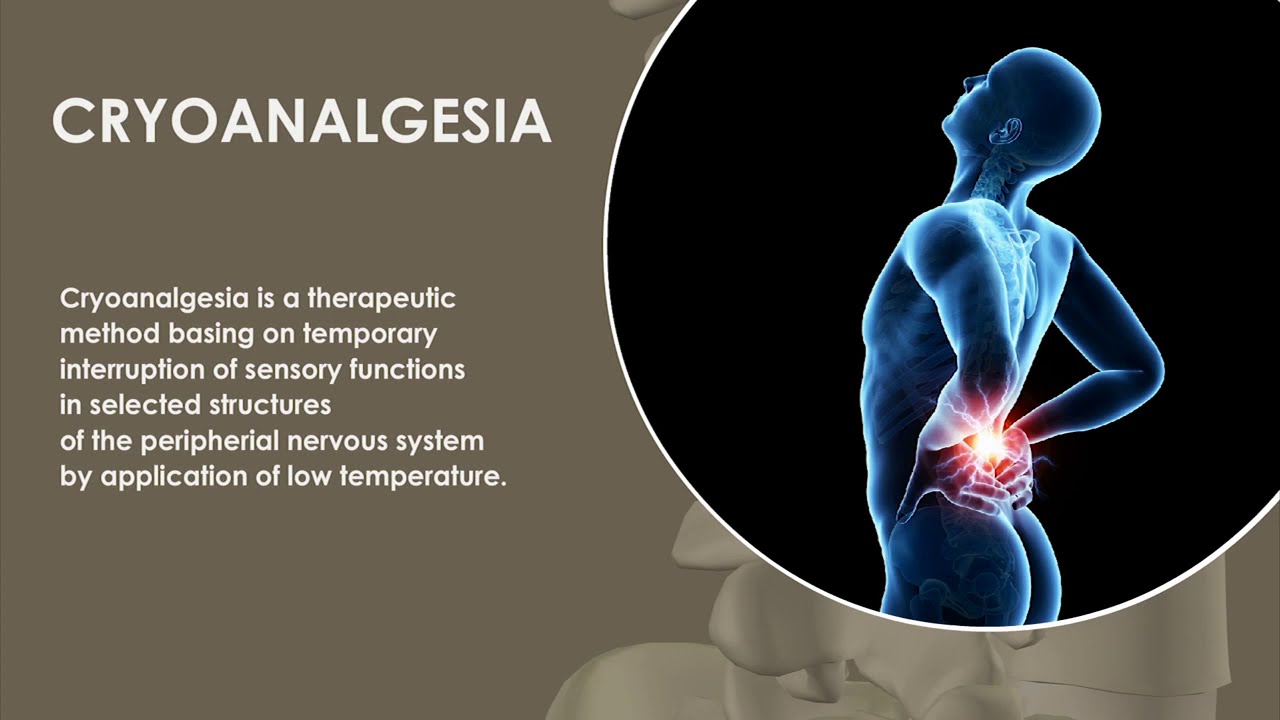 Cryoneurolysis for lower back pain - YouTube