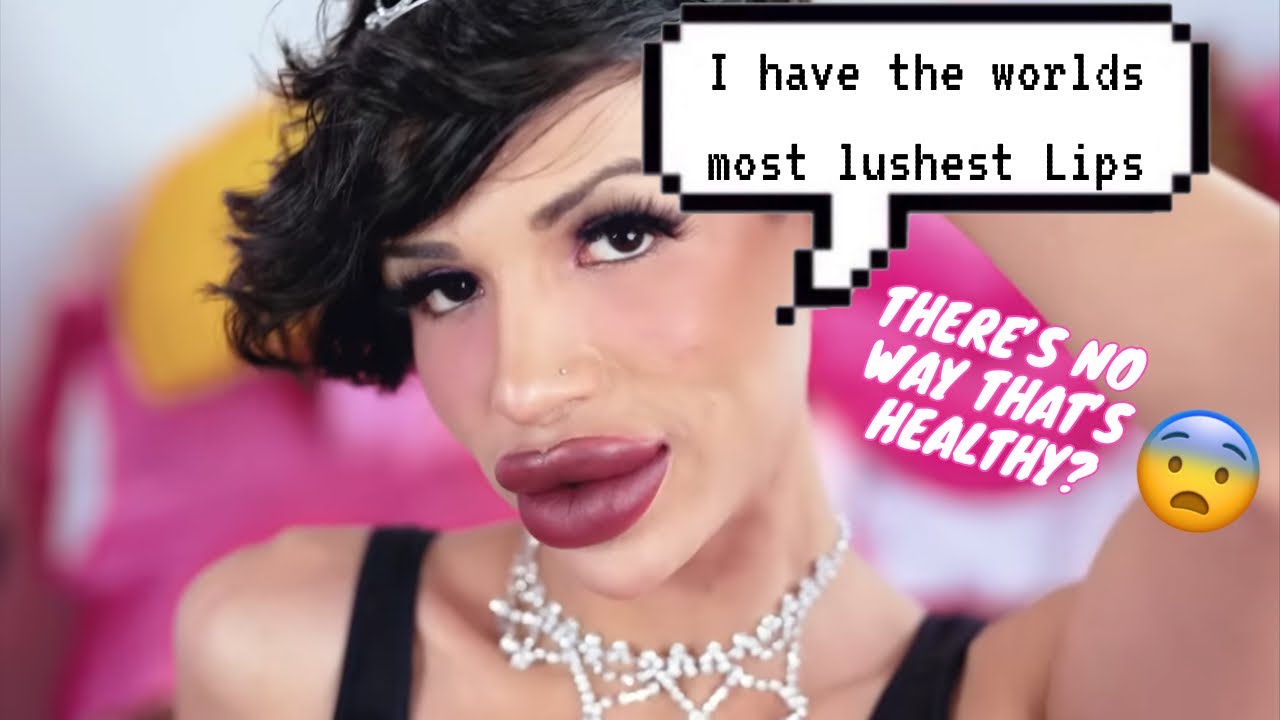 Yep! I’m Canceled 😬| I’ll keep getting Fillers until My Lips Explode | Hooked On The Look ...