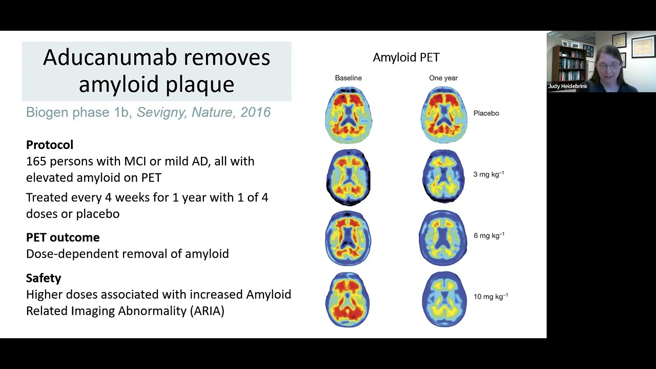 What’s New in Alzheimer’s Disease Clinical Trials? - YouTube