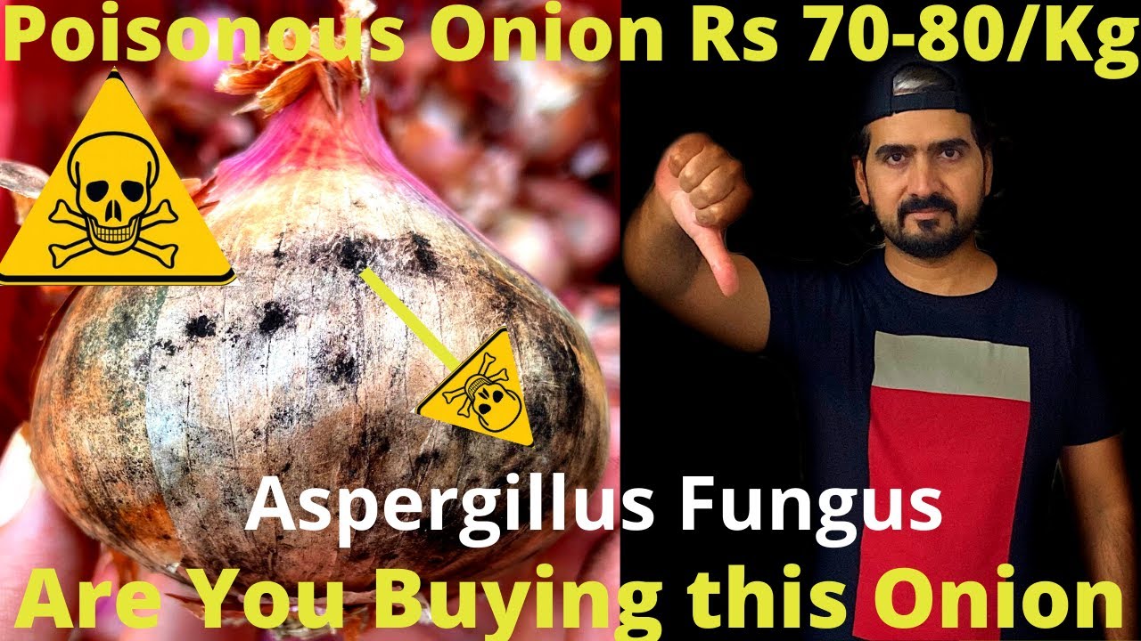 Aspergillus fungus on Onion | Poisonous Onions | Aspergillus causes of ...