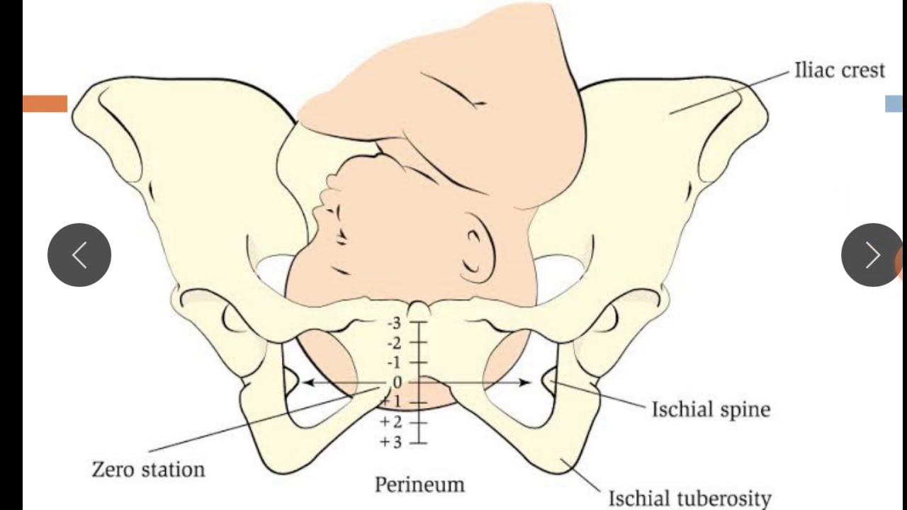 Difference Between Male & Female pelvis | Types of Pelvis | Female ...