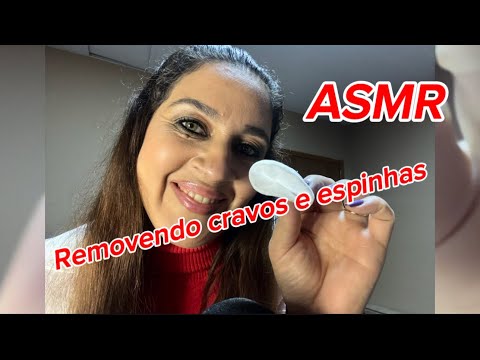ASMR: Removendo cravos e espinhas