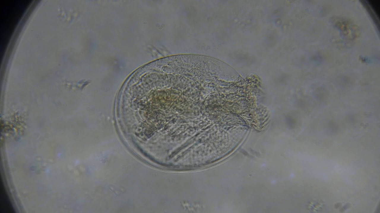 Rotifier (Rotifera Testudinella) - YouTube