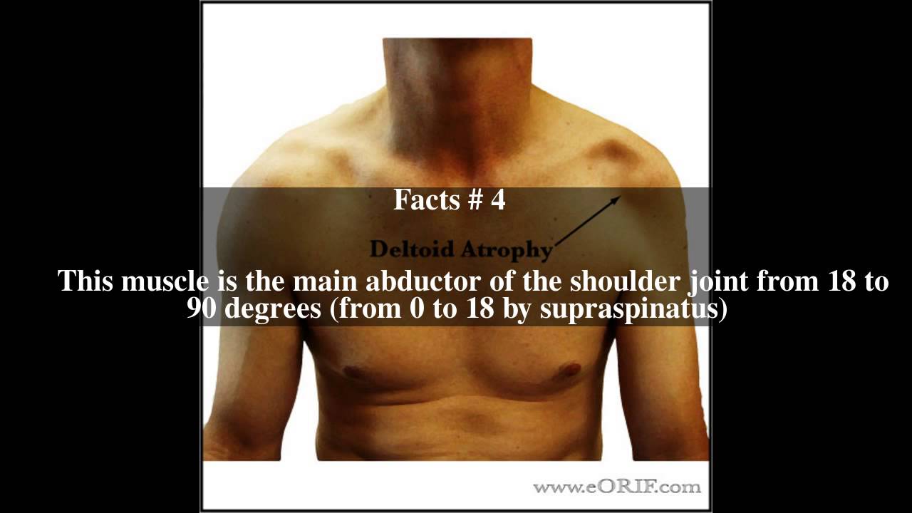 Injury of axillary nerve Top # 6 Facts - YouTube