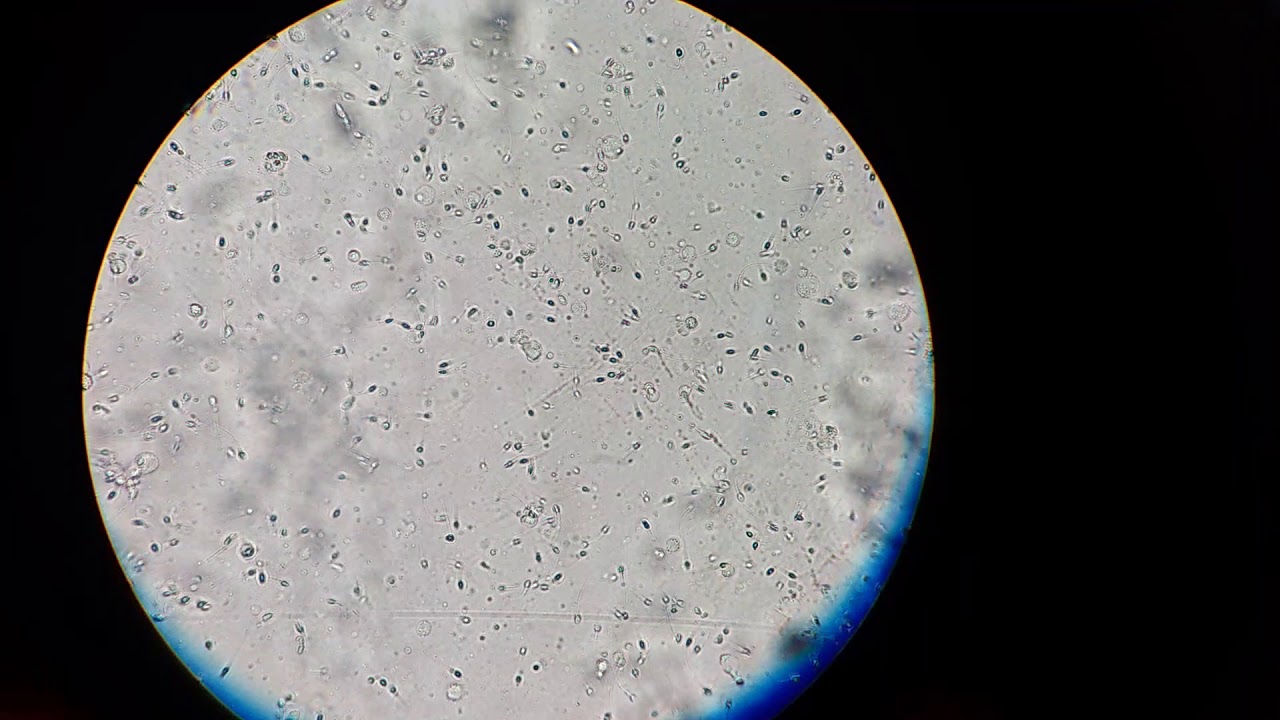 Esperma humano al microscopio. - YouTube